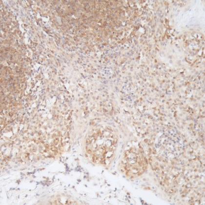 Bcl-10供应商_生产厂家 -厦门通灵生物医药科技股份有限公司