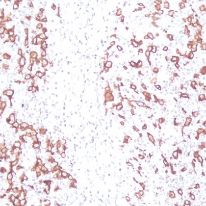 CD30供应商_生产厂家 -厦门通灵生物医药科技股份有限公司