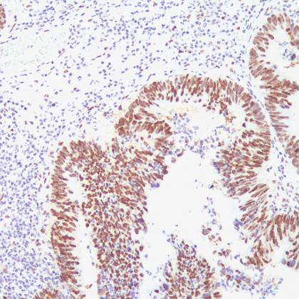 MSH2供应商_生产厂家 -厦门通灵生物医药科技股份有限公司